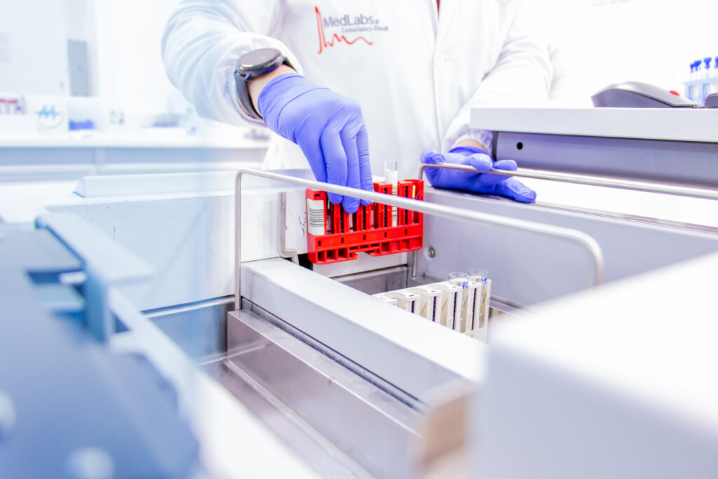 Patient Testing Services for Accurate Diagnostics | MedLabs